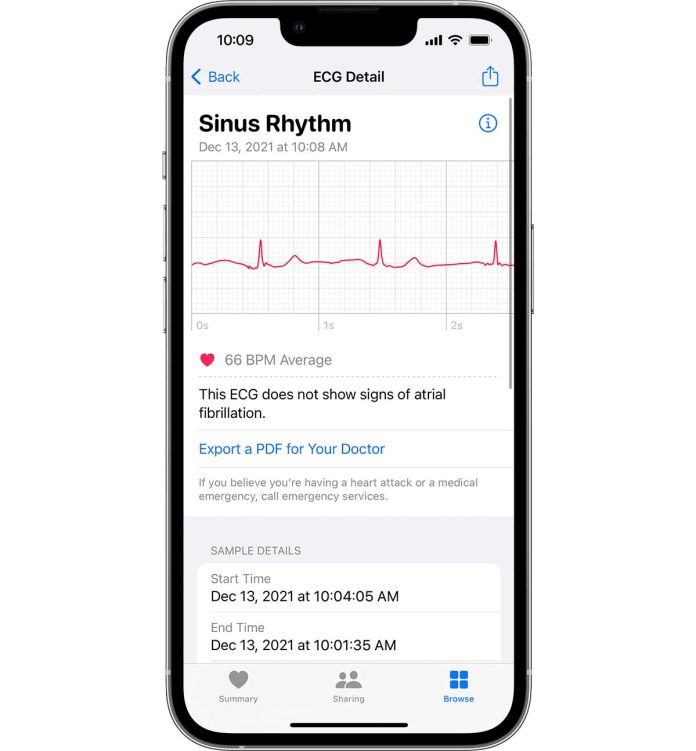 Apple Watch ECG isn't working? Here's how to fix it - MyHealthyApple