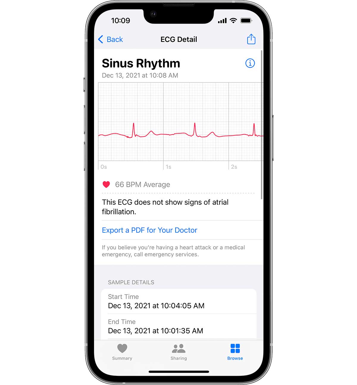 Apple Watch ECG isn't working? Here's how to fix it - MyHealthyApple