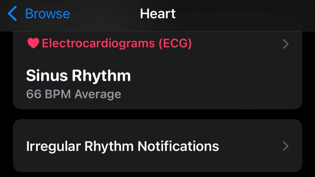 How to use the Irregular Heart Rhythm notification feature on Apple ...