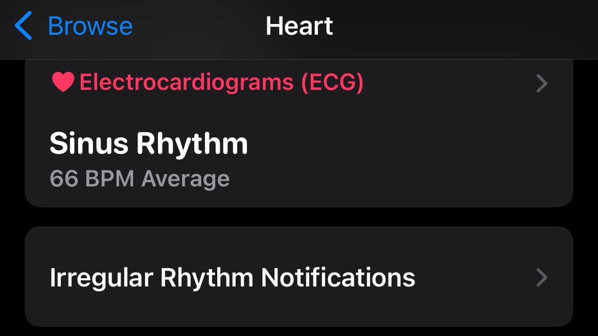 How to use the Irregular Heart Rhythm notification feature on Apple ...