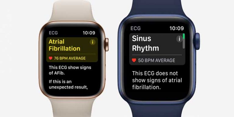 How to use the Irregular Heart Rhythm notification feature on Apple ...