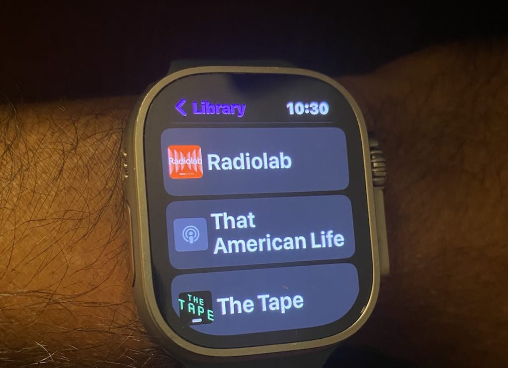 Apple Watch Faces missing or disappeared? Try these steps - MyHealthyApple