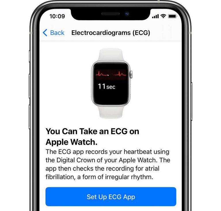 How to use the Irregular Heart Rhythm notification feature on Apple ...