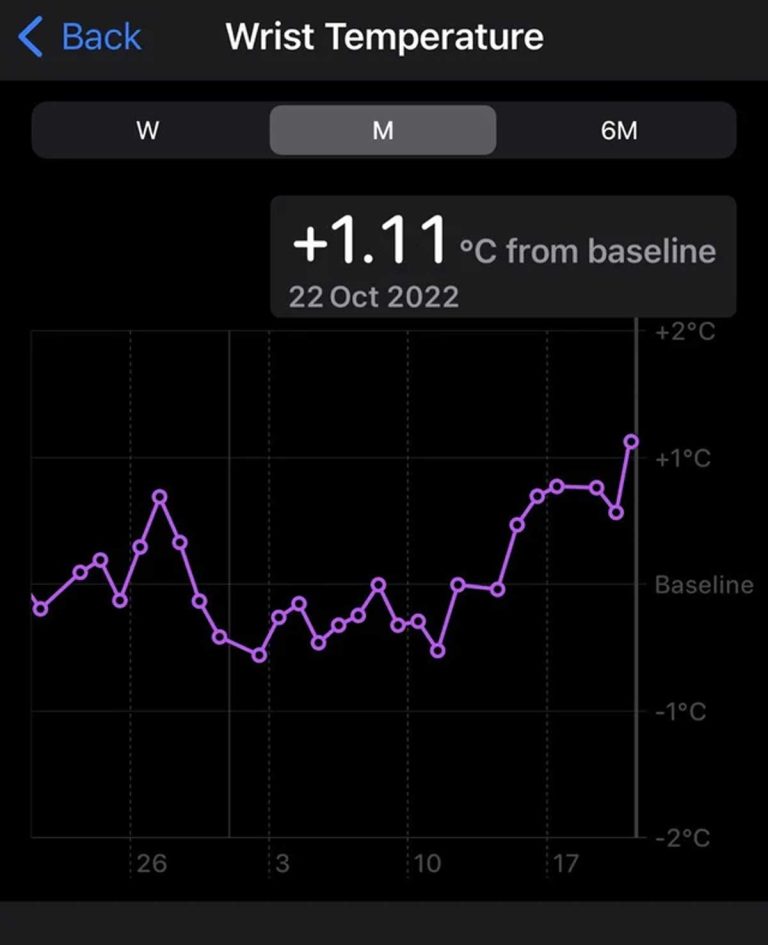 How to check your skin and body temperature on your Apple Watch ...