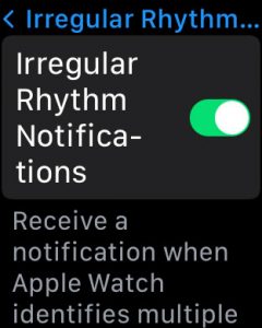 How to use the Irregular Heart Rhythm notification feature on Apple ...