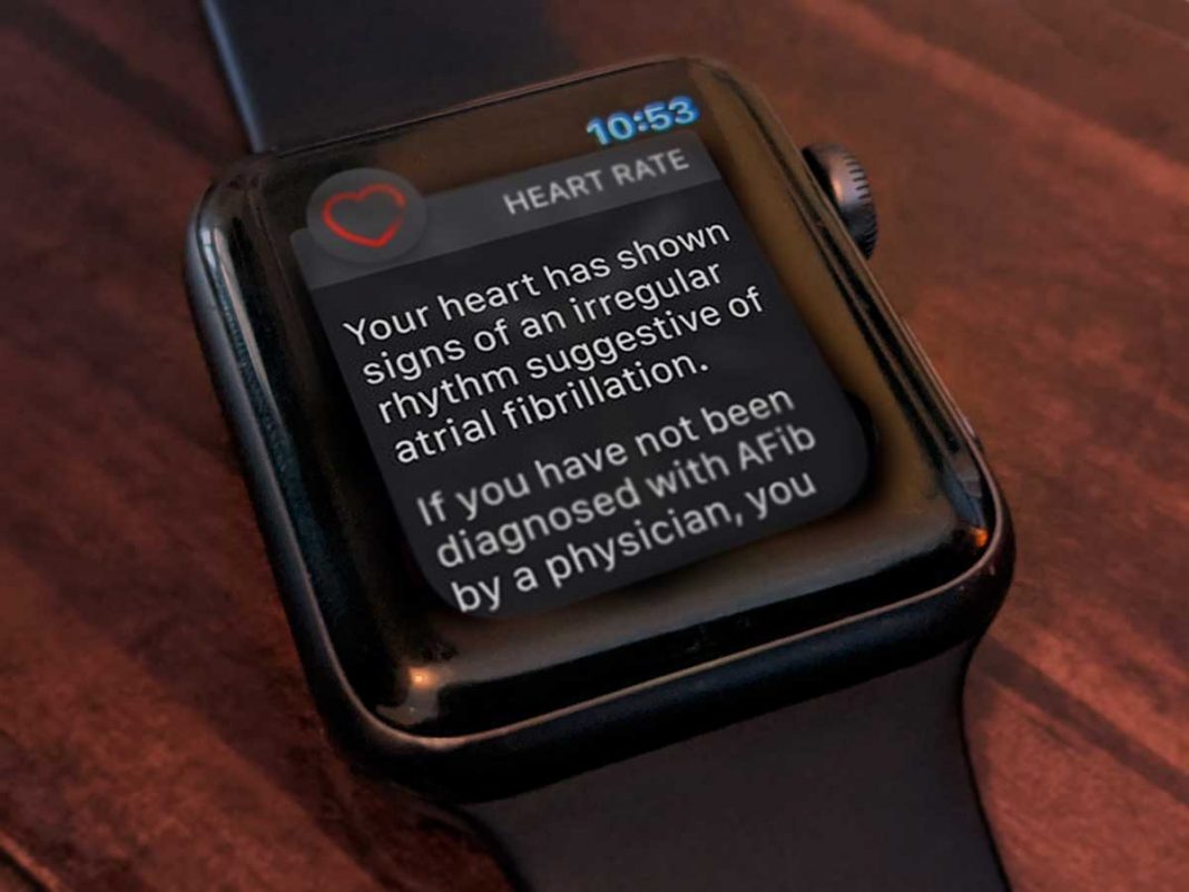 How to use the Irregular Heart Rhythm notification feature on Apple ...