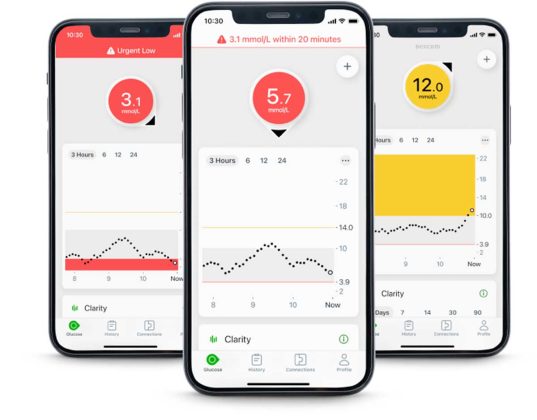 Top 11 tips and tricks for Dexcom G7 users using an iPhone and Apple ...