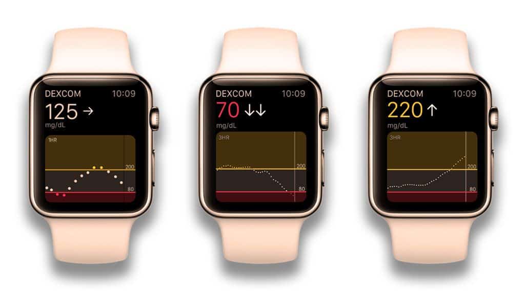 Where Should You Insert Attach The Dexcom G7 Or G6 CGM Sensor On Your