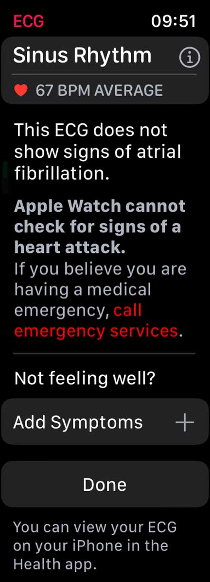 What health conditions can Apple Watch help you monitor? - MyHealthyApple