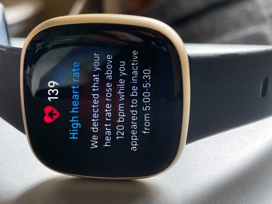 How to remove unwanted notifications on your Fitbit - MyHealthyApple