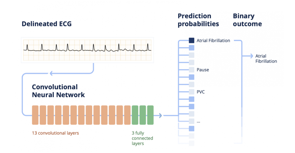 Cardiologs AI enhances quality of Apple Watch ECG readings - MyHealthyApple