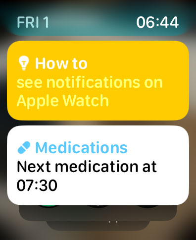 Widgets on Apple Watch, a new road to delight watch owners with watchOS ...