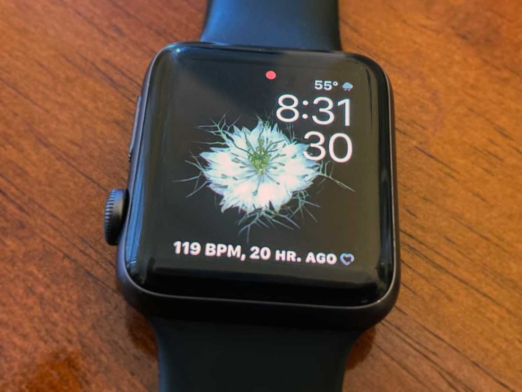 My Apple Watch's screen and watch face is upside down! It's an easy fix ...
