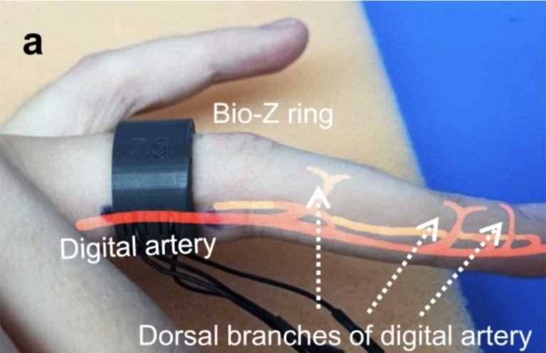 How smart rings could monitor blood pressure — and how accurate it ...