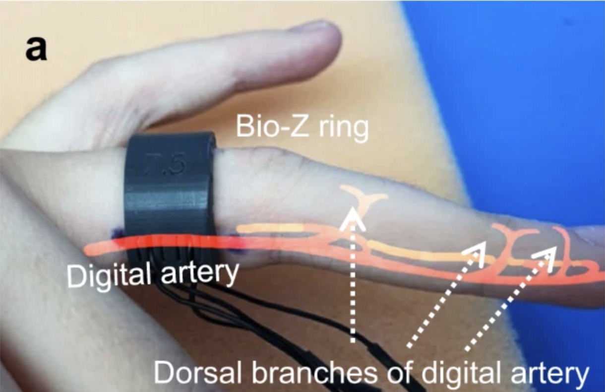 How smart rings could monitor blood pressure — and how accurate it ...